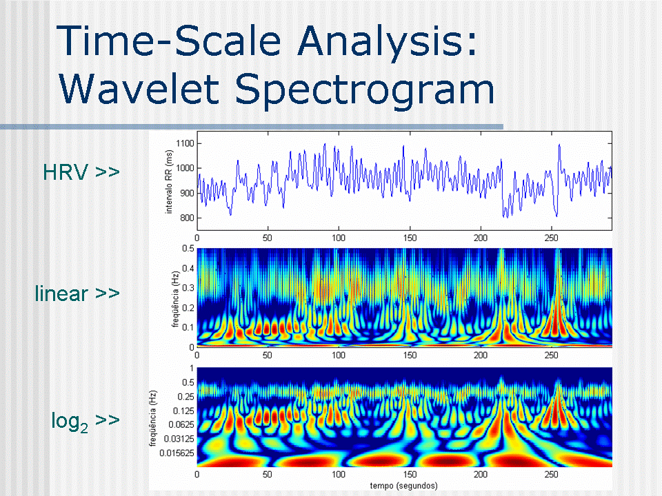 Aula sobre HRV (2004)